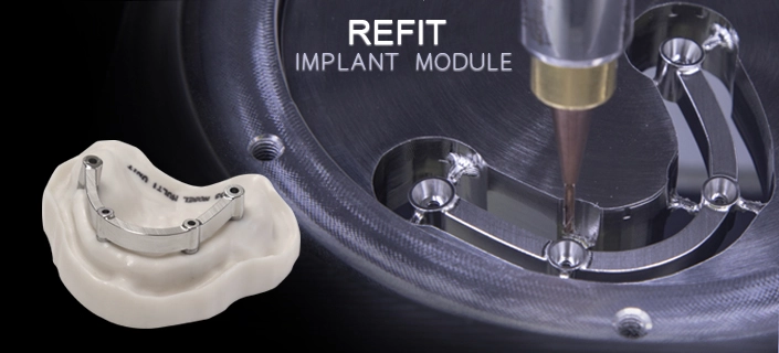 iCAM V5 smart ReFit Implant Module – Precision in the CAD/CAM workflow