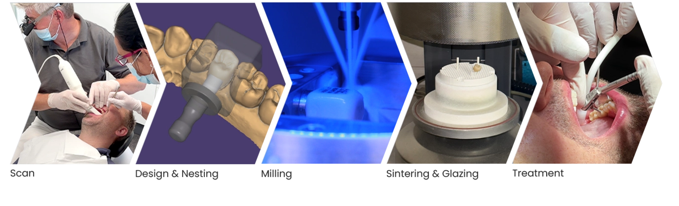 Chairside in everyday practice: time & cost-saving fabrication