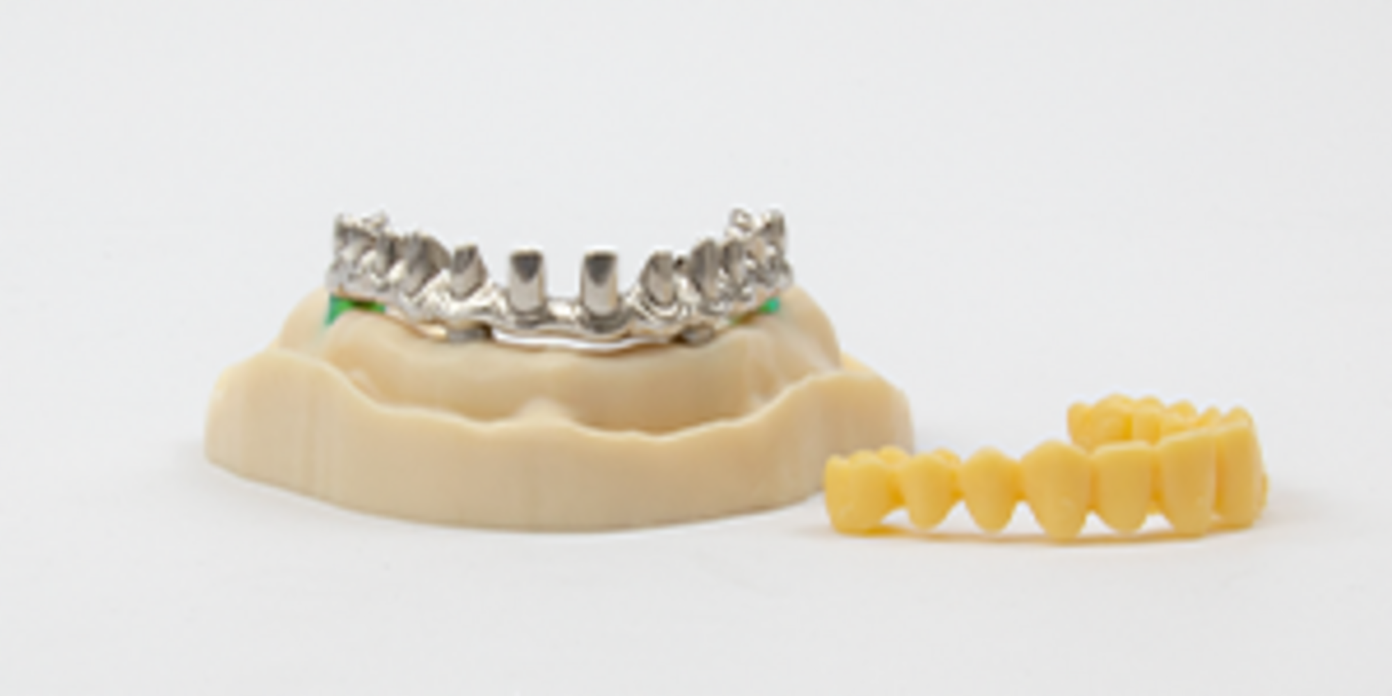 Telescopic technology in dental technology: A comprehensive guide