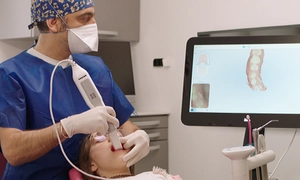 Digital impressions: a revolution in dentistry