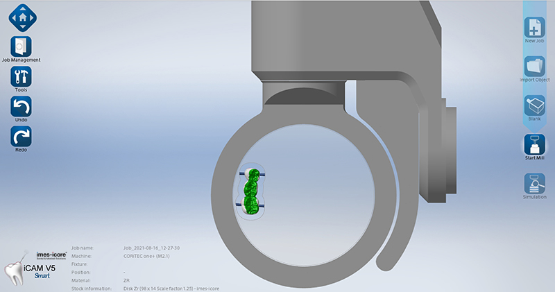 CORiTEC one+ - High-end solution for limitless indications