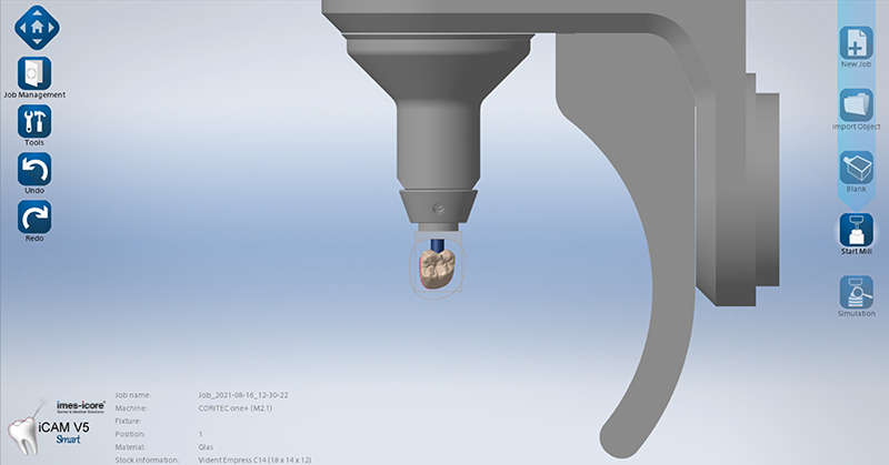 CORiTEC one+ - High-end solution for limitless indications