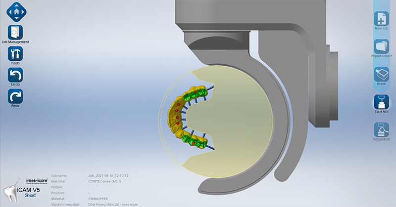CORiTEC one+ - High-end solution for limitless indications