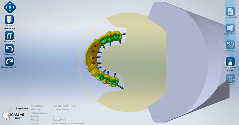 Dentalfräsmaschine CORiTEC 350i Serie – Vollautomatisierte High-End-Lösung